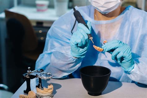 Interim Partial Denture Uses And Options Stomadent