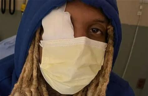 Lil Durk Hit By Stage Pyrotechnics