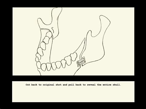 Skull At Anatomy And Art