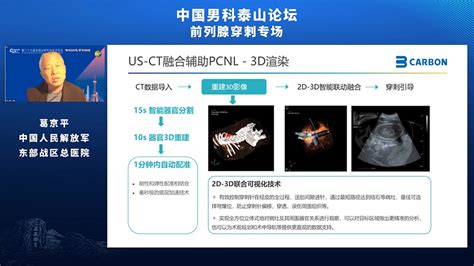 群英荟萃，共话多模态影像融合在泌尿外科的应用与发展
