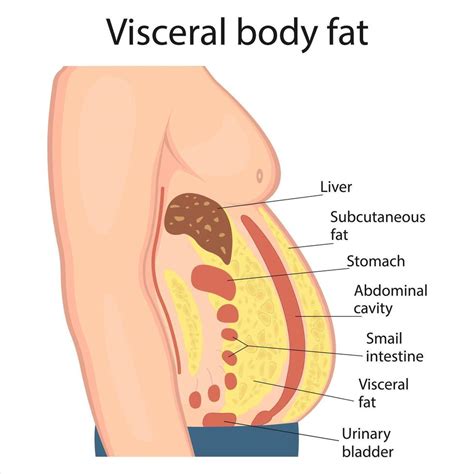 Visceral Fat And Subcutaneous Fat Accumulate Around Organs Medicine And Health Diagram About