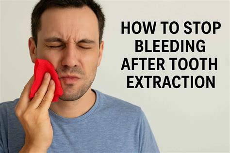 How To Fix Overbite 5 Effective Solutions Credihealth