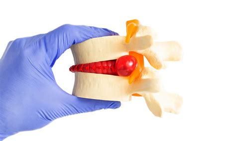 Non Surgical Back and Neck Hernia Treatments Doç Dr Mustafa Kılıç