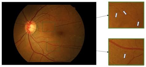 Biomedicines Free Full Text Local Structure Awareness Based Retinal