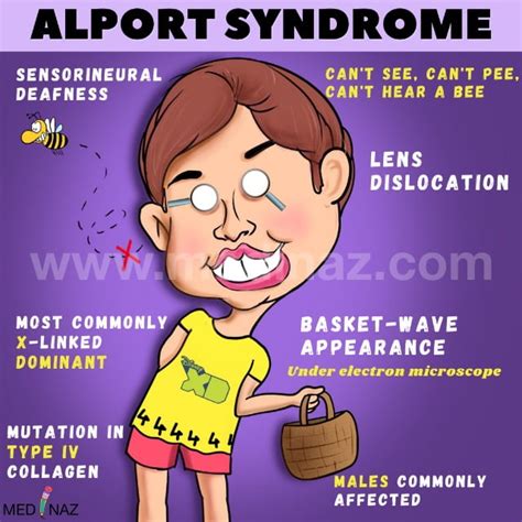 Alport Syndrome Usmle Notes