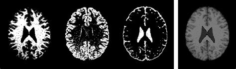 Segmentation Results Of Simulated Brain Mr Images A Original Image
