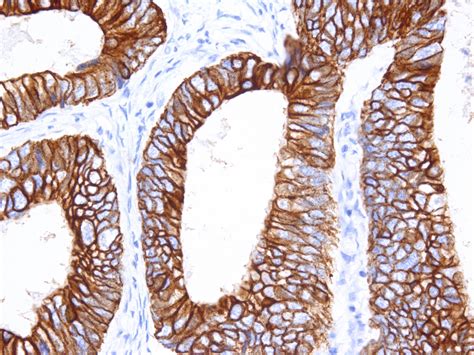 Anti Cytokeratin 18 Monoclonal Antibody Cloneihc01844 1027
