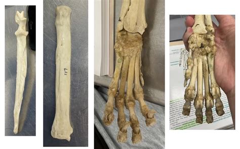 Radius Ulna Carpus Metacarpus Phalangs Lab Diagram Quizlet