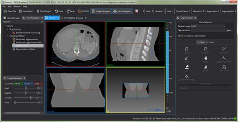 Medical Imaging Interaction Toolkit Gui Based Radiomics Tutorial Creating A Basic Segmentation