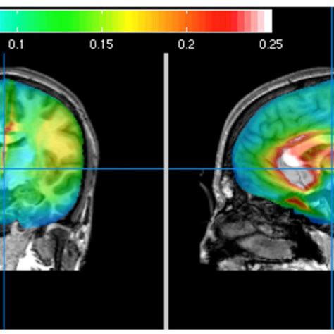 Average Maximum And Minimum Angular Deflections Degrees Download Scientific Diagram