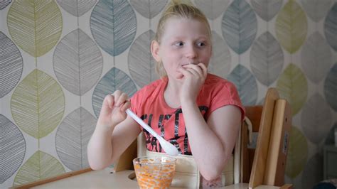 11 year-old has permanent smile - due to rare genetic condition - YouTube