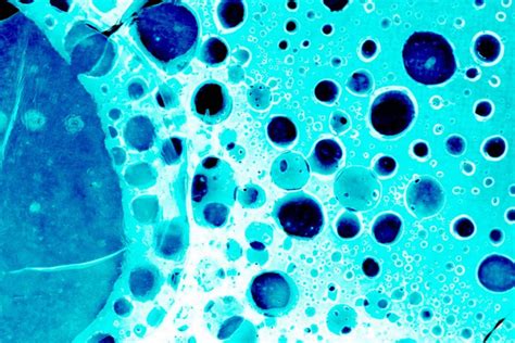 New Research Supports Idea That A Disrupted Circadian Rhythm Is Linked