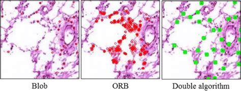 Experimental Results Of Feature Detection Algorithms Download