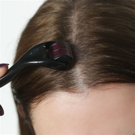 What Does Microneedling Look Like