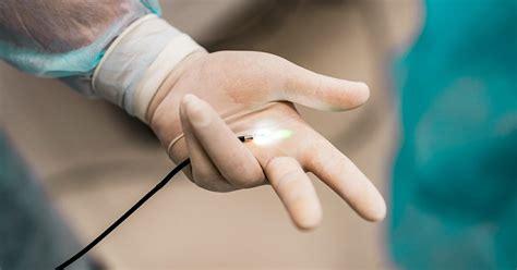 Ercp Procedure For Digestive Diseases Benefits And Risks