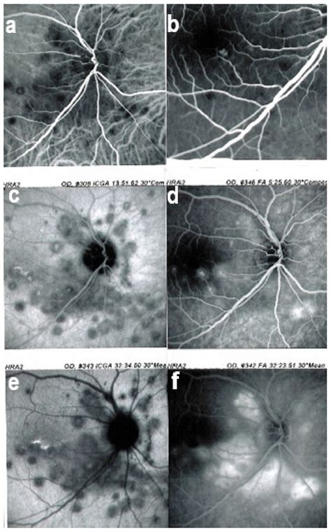 Diagnostics Free Full Text Classification Of Non Infectious And Or