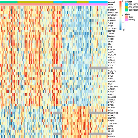 Heatmap Of The 50 Most Significant Genes In SLE Data Without Imputation