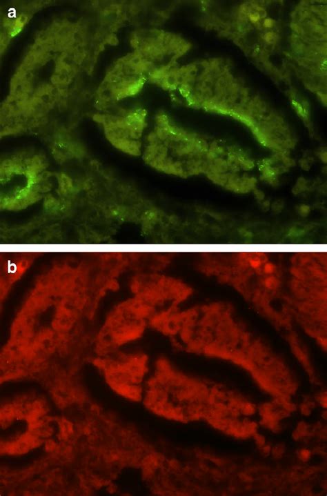 Effect Of Controlled Autolysis At 20 C For 28 Days Before Fixation