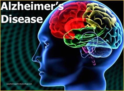 47 Free Alzheimer Powerpoint Template Heritagechristiancollege