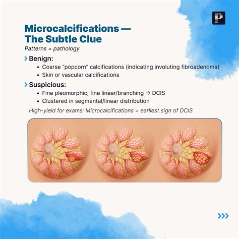 Prepladder Neet Ss Added A New Photo Prepladder Neet Ss