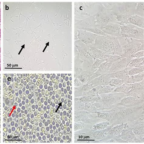 Isolation Was Performed From The Distal Lobe Of The Right Lung A Hande