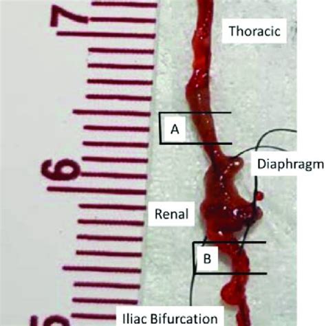 Extracted Mouse Aorta With Labeled Aortic Landmarks And Sections Download Scientific Diagram