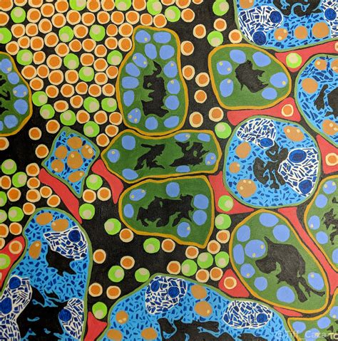 Light Chain Proximal Tubulopathy Art Of Medicine Arkana Laboratories