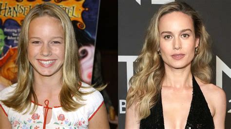 Brie Larson Plastic Surgery Check Out Her Transformation