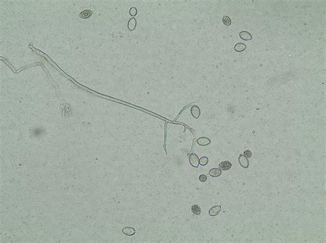 Phytophthora Infestans Microscope