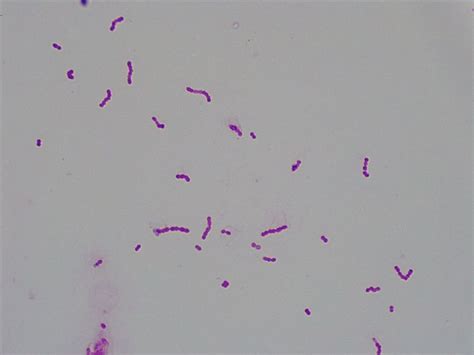 Enterococcus Faecium Identified In Csf Cytology From A Patient With Common B All