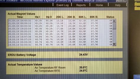 Aleksandar Peric On Linkedin Is This Normal For Siemens Symphony Tim