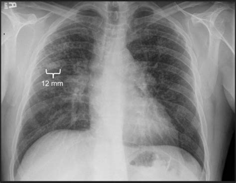 Ilo Classification Flashcards Quizlet