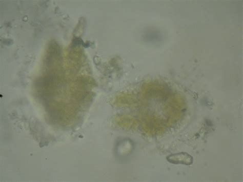 Phytoplankton Identification