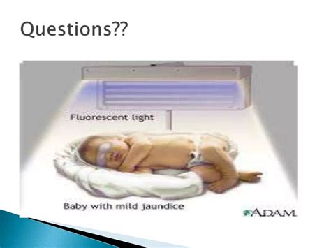 Neonatal Jaundice Ppt
