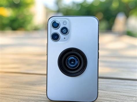 인공지능ai 의료 기술