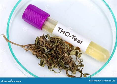 Urine Samples For Testing THC In The Laboratory Stock Photo Image Of Science Disease 257026404