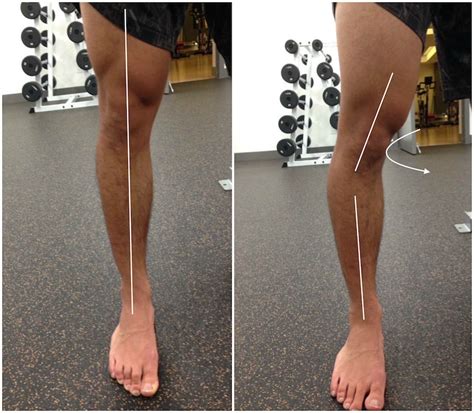 Build Your Arch Why Flat Feet Kill Your Squat Elite Fts Elitefts