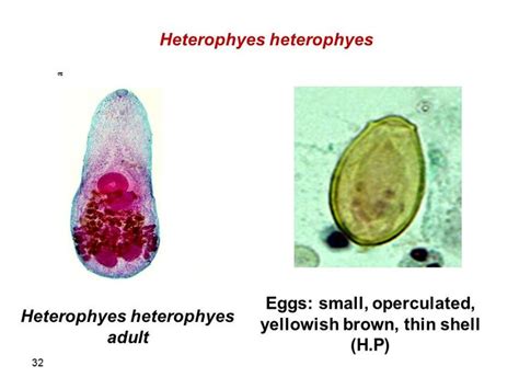 Heterophyes Heterophyes Adult And Egg Diagram