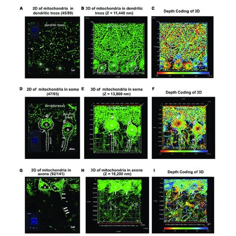 Two And Three Dimensional 2D And 3D Images Acquisition Of