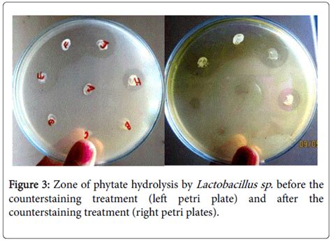 In Vitro Cholesterol Assimilation And Functional Enzymatic Activi