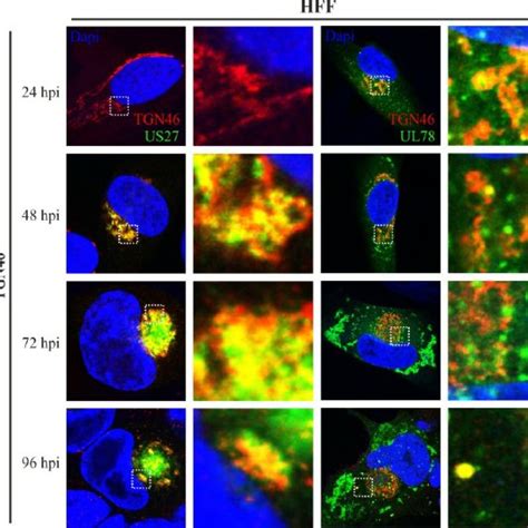 Eea1 Staining Of Us27 Eyfp And Ul78 Eyfp Infected Hffs And Arpe 19