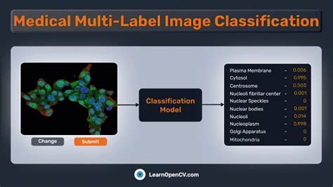 Loïc Lauréote On Linkedin Enhancing Medical Multi Label Image Classification Using Pytorch