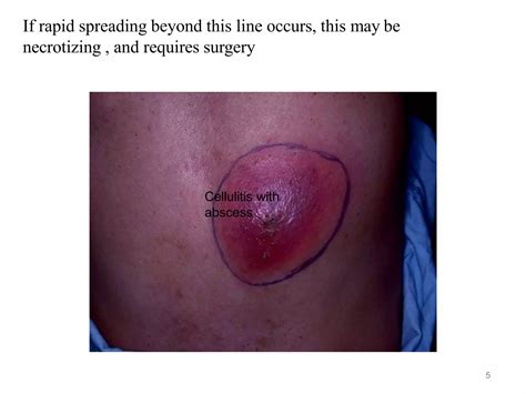 3 Lec 4 Integument System Path 321pptx