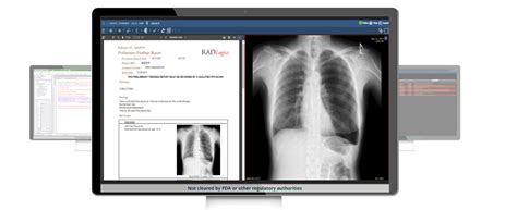 Ai Based Covid Detection Wego