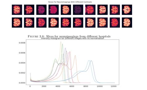 Github Weiziyoung Predicting Brain Age Supplement Code For My Master Thesis Predicting Brain
