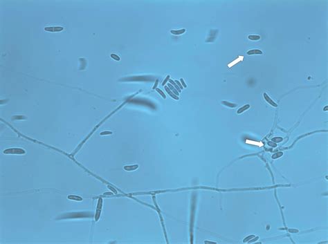 [table Fig 7]