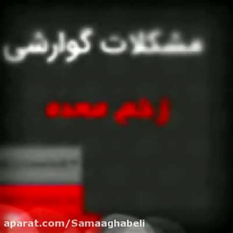 درمان سندروم روده تحریک پذیر و التهابات روده چیست؟؟