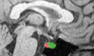 Structurefunction Relationship Of The Pituitary Gland In Anorexia