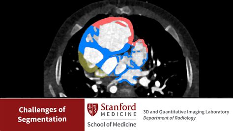 Challenges Of Segmentation