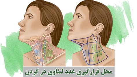 Different Lymph Node Levels In The Neck دکتر علی ستایش جراح عمومی و